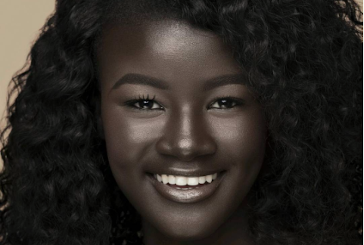 Vrouw die gepest werd om haar huidskleur is nu model | Marie Claire